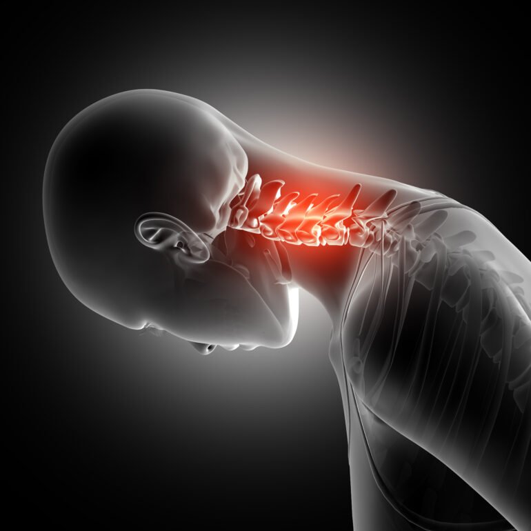 Neck Pain – Dr.Samir Parekh